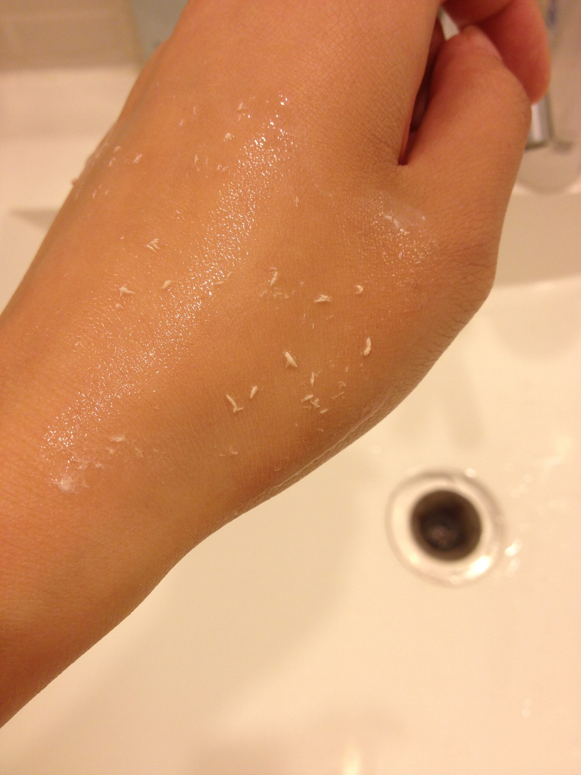 When I Rub My Skin It Rolls Off? Understanding Skin Behavior and ...